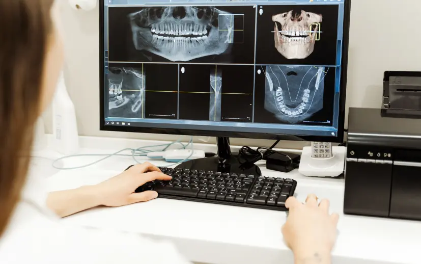 3D Dental Tomography (CBCT) | Fast, Safe and Comfortable Scanning